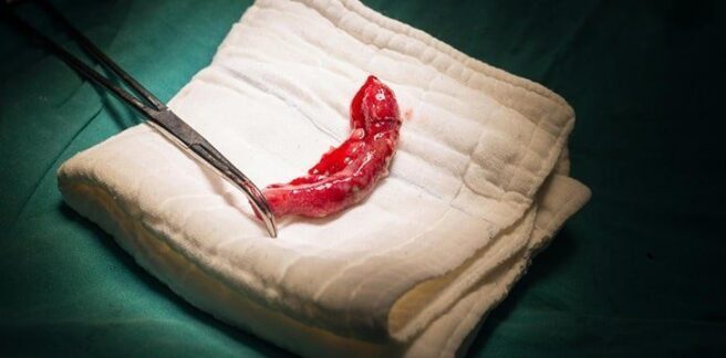 What Is The Appendix? - The Fact Site