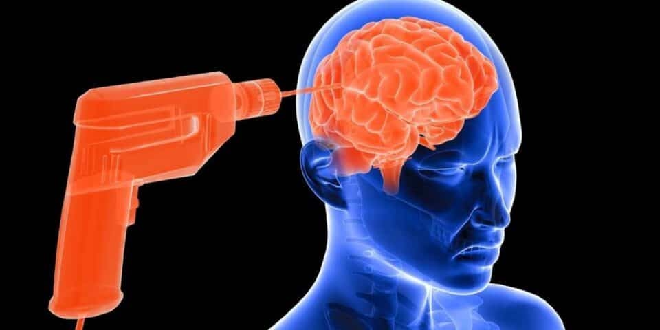 8 Old Medical Practices That Did More Harm Than Good - The Fact Site