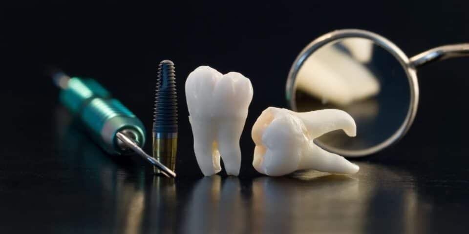 Why Do We Have Wisdom Teeth? - The Fact Site